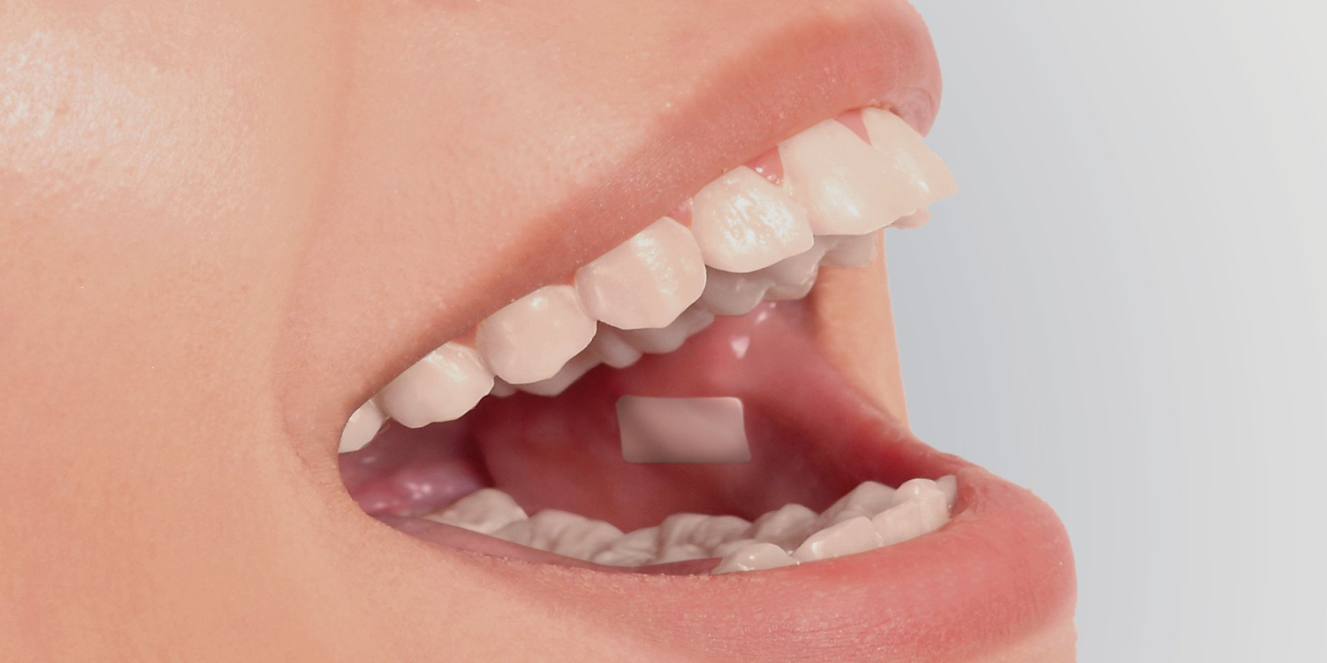 Overview: Oral films and their administration routes