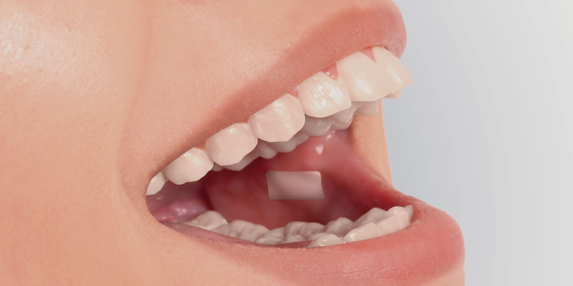 Overview: Oral films and their administration routes